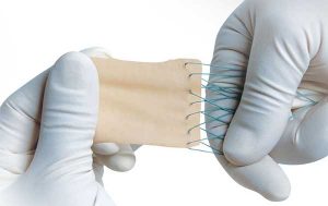 Allopatch HD® - Acellular Human Dermis