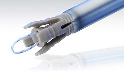 TenoLok™Dual-Expanding Tenodesis Anchor